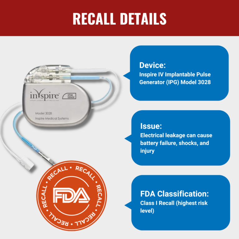 Inspire Sleep Apnea Device Recall